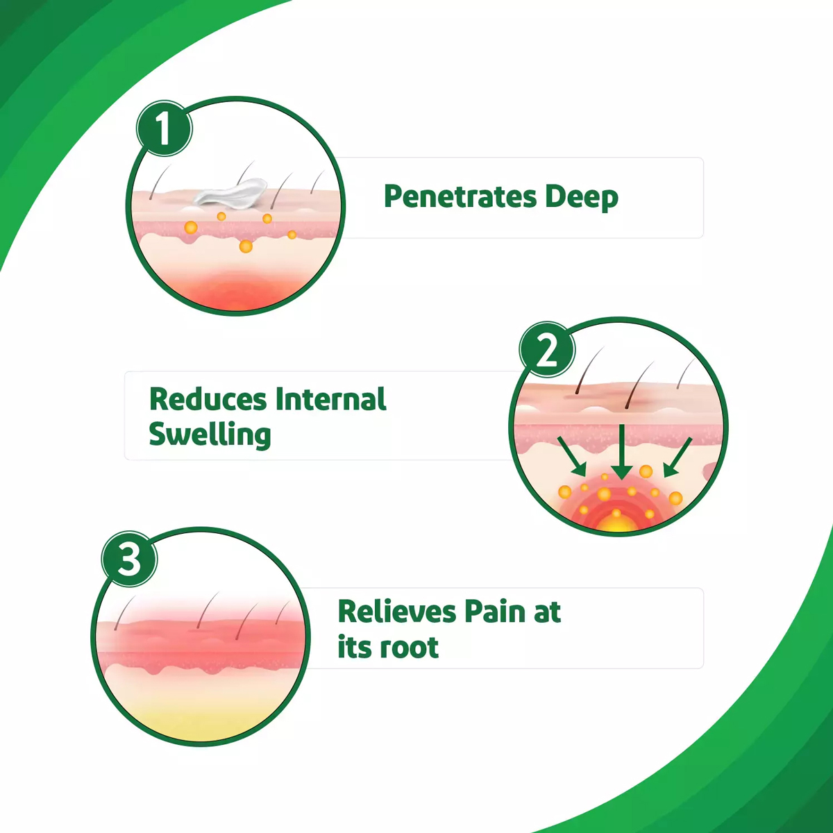 Iodex Ultra Gel, 30 gm Price, Uses, Side Effects, Composition - Apollo ...
